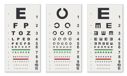 About Visual Function | Ashfield Eye Clinic